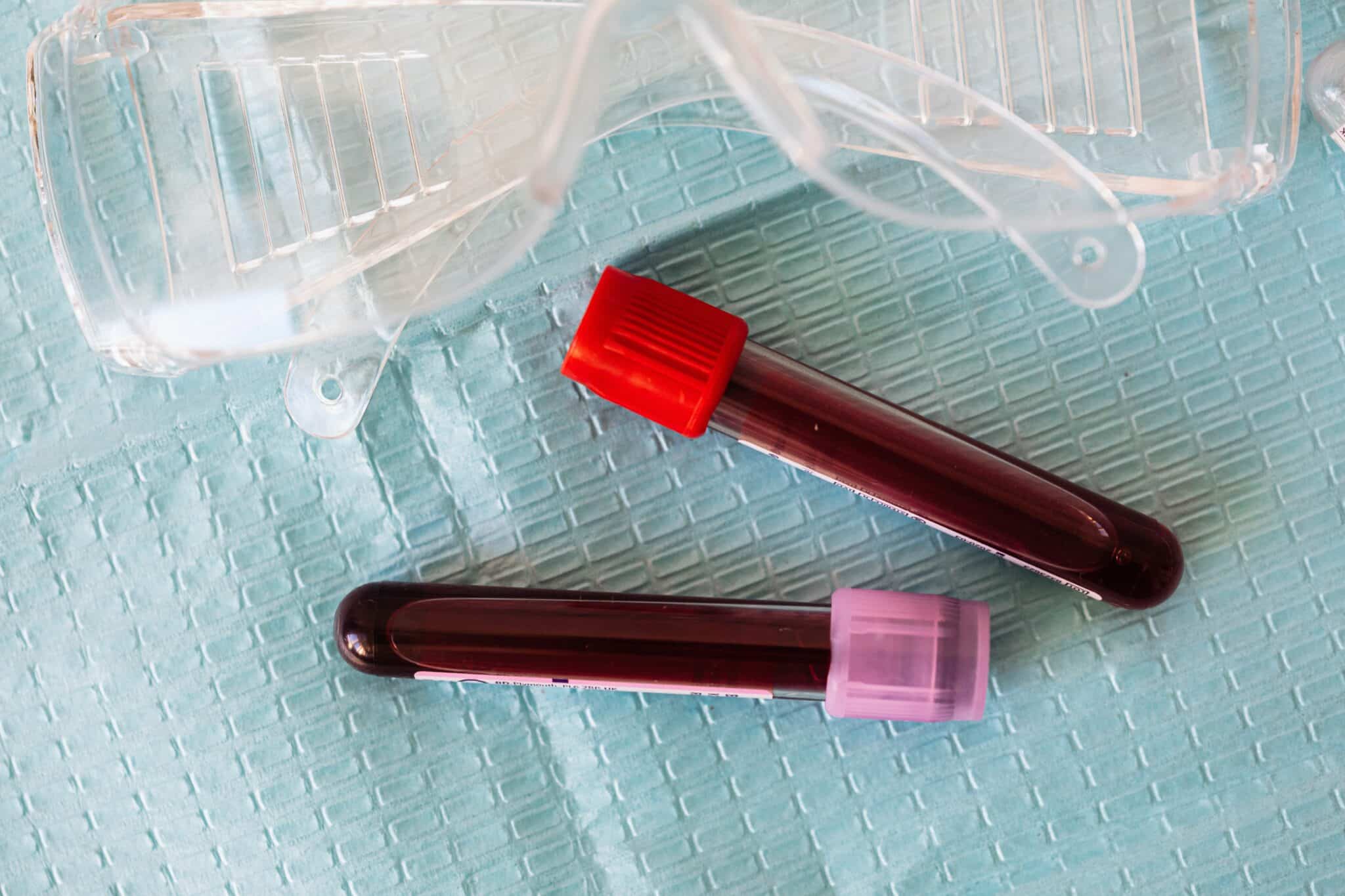 ¿Por qué la sangre es roja?